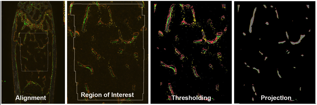 Image Analysis | Bonebase